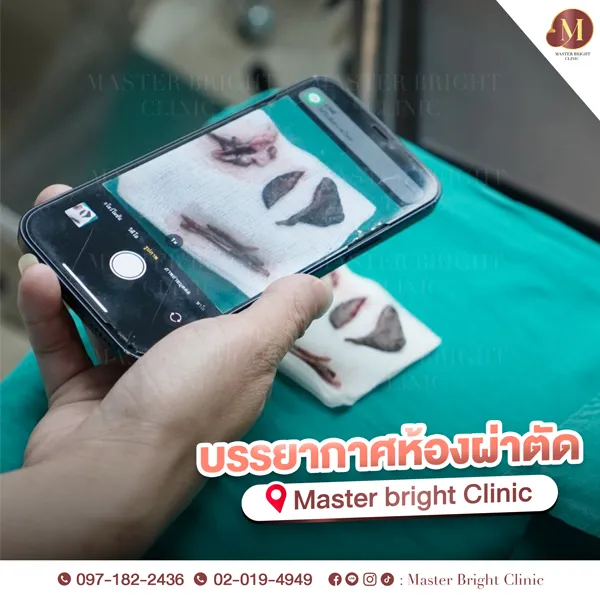 รีเเพร์ - masterbrightclinic